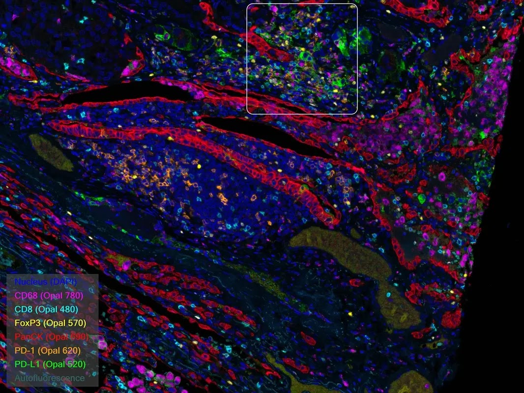 Advanced Diagnostic Platform & Panels - iCura Diagnostics
